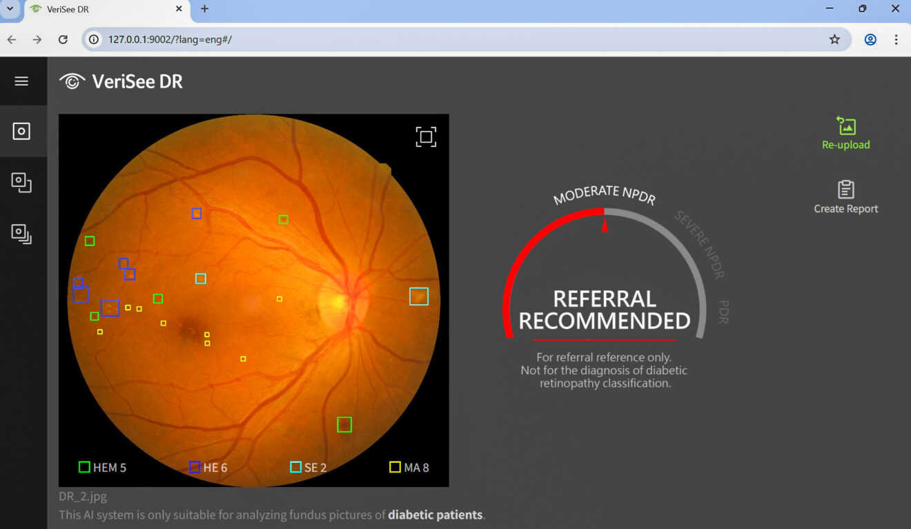 Intel-Backed AI PC Helps Cut Eye Lesion Detection from Weeks to Seconds ...